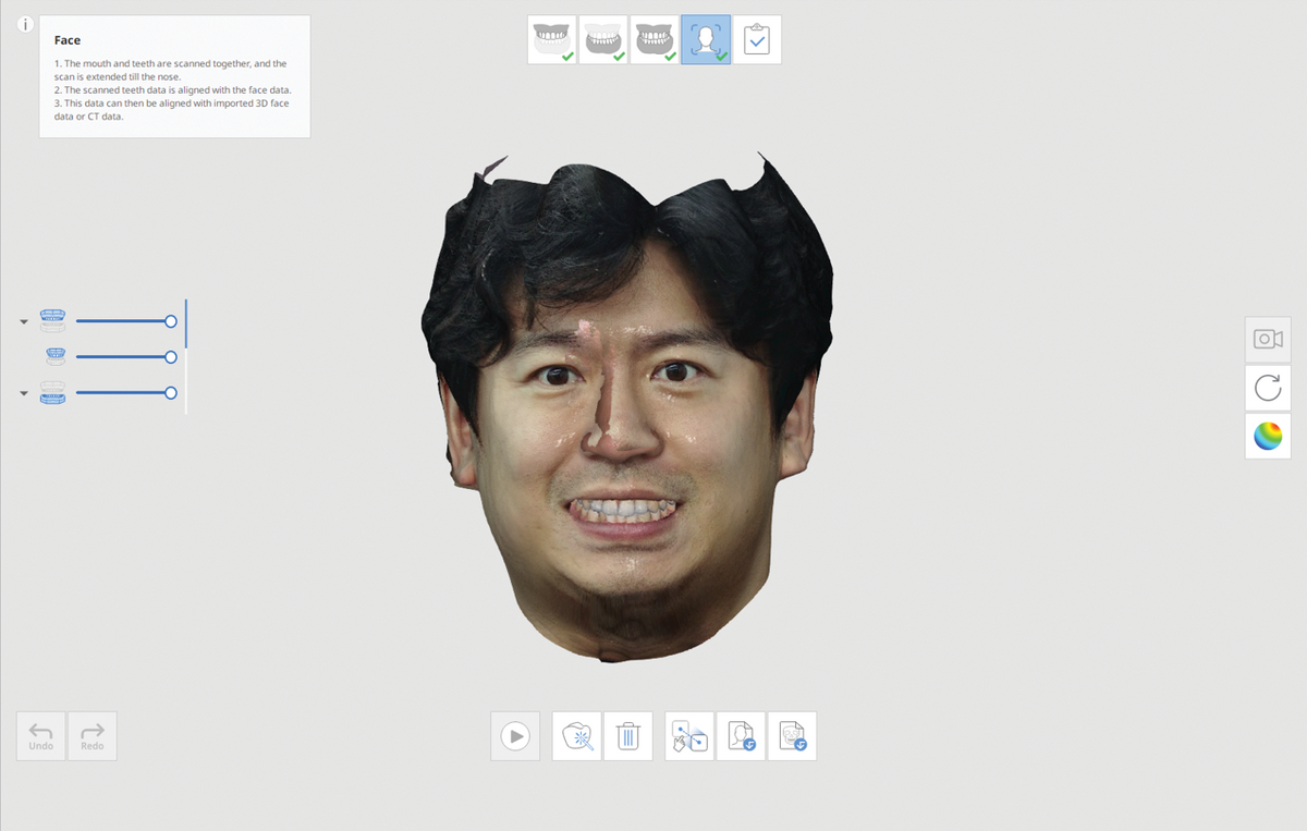 Medit i700 Intraoral 3D Scanner - NEO IMPLANTS