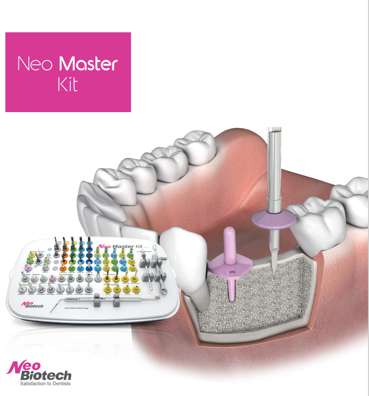 Neo Master Kit | Neo Implants - NEO IMPLANTS